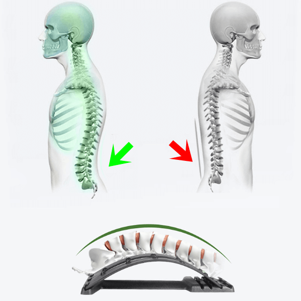 Back Stretcher For Spine Stretching And Elongation – SmarterWomen.com